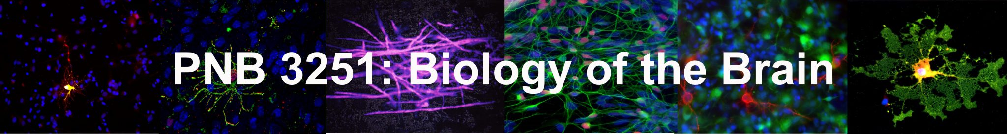 UCONN Class - Biology of the Brain | Undergraduate Summer Study Abroad ...